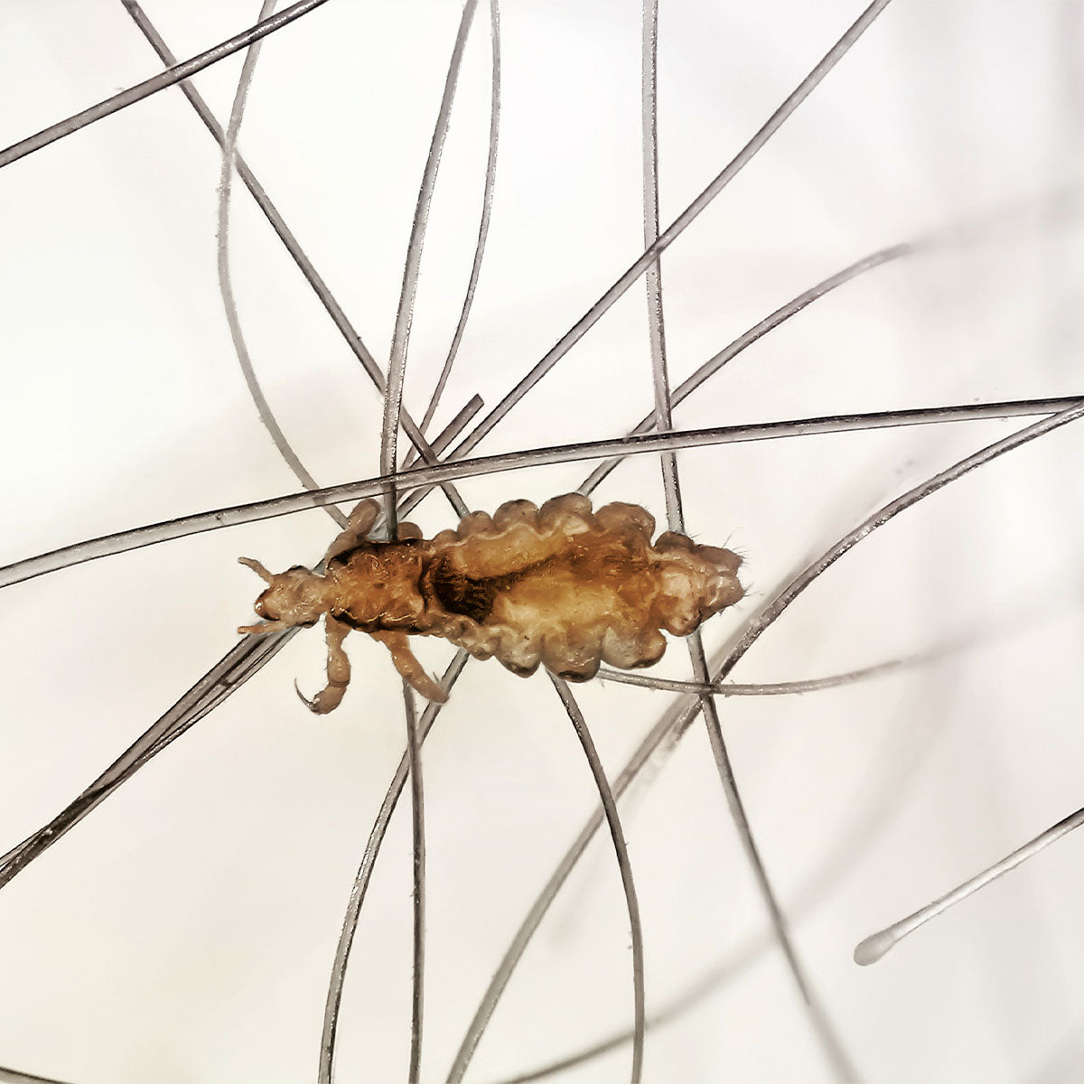 How to get rid of lice and nits – ISpyNits